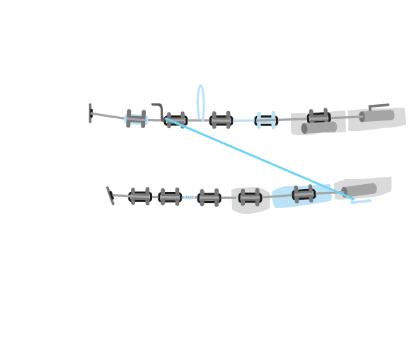 How to Know if You Need Braces | Crawford Orthodontics